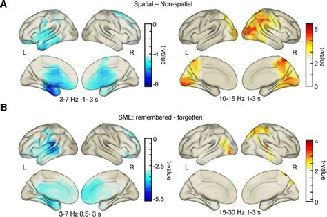 eeg source localization results a decreases in theta power for download scientific diagram