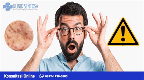 Ciri Ciri Gejala Penyakit Raja Singa Pada Pria Klinik Utama Sentosa