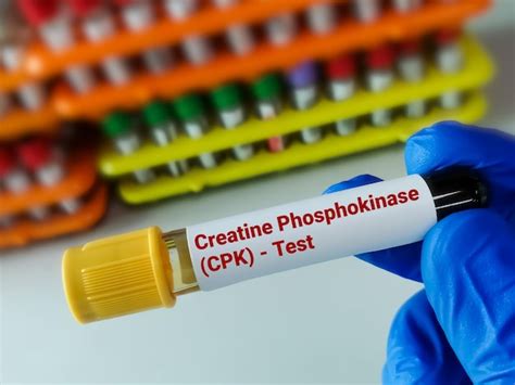 Científico sosteniendo una muestra de sangre para la prueba de