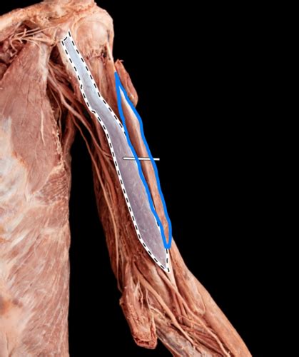 Muscles Of The Upper And Lower Limbs Flashcards Quizlet