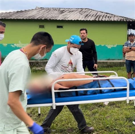 Morre indígena que foi baleado por garimpeiros em Roraima Roraima em