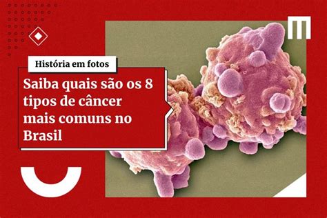 Veja quais são os oito tipos de câncer mais comuns no Brasil