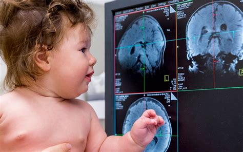 Brain Imaging Mit Mcgovern Institute