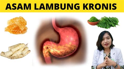 MAKANAN TERBAIK OBAT ASAM LAMBUNG Dr Emasuperr YouTube