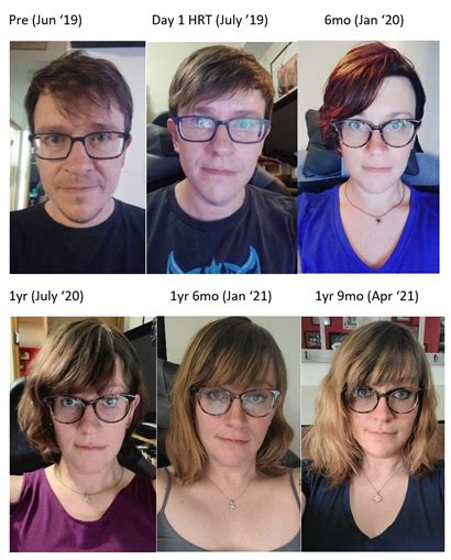 Longer Timeline From Pre HRT Through Now Started HRT At 35 And It S