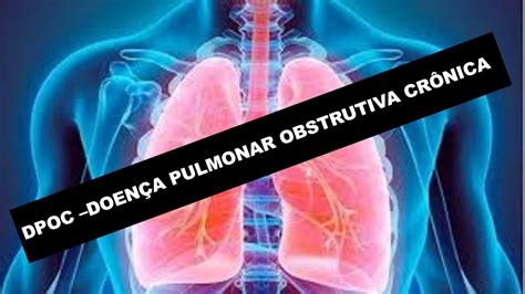DPOC DOENÇA PULMONAR OBSTRUTIVA CRONICA ENFISEMA PULMONAR E BRONQUITE