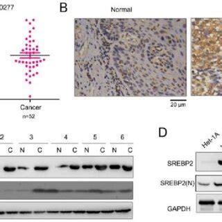 SREBP2 Is Upregulated In ESCC A SREBP2 MRNA Expression Levels In
