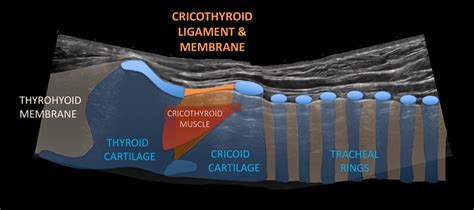 Airway Ultrasound Longitudinal Views LITFL Ultrasound Library