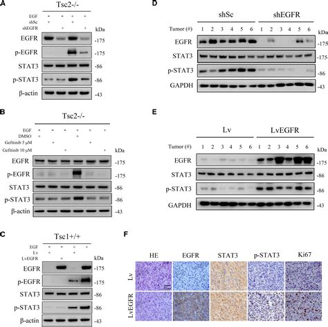 Runx Egfr Pathway Contributes To Stat Activation And Tumor Growth