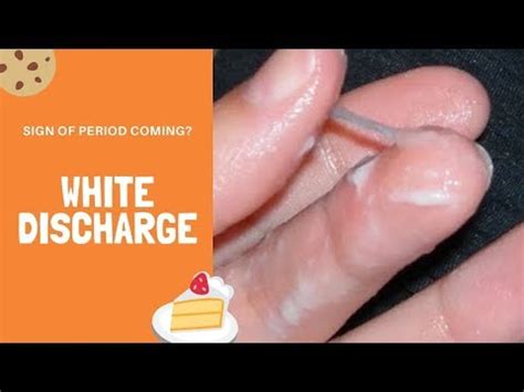 Is White Discharge A Sign Of Period Coming What Does A Milky White