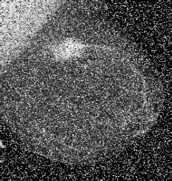 Salt And Pepper Impulse Denoising Opencv Opencv Q A Forum