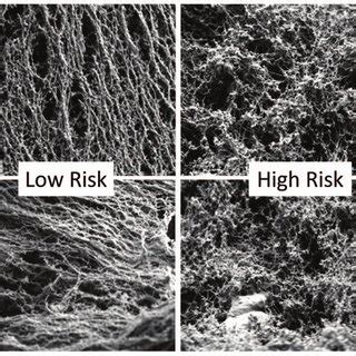Example Scanning Electron Microscopy Images Cervical Mucus Samples