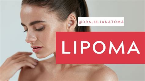 LIPOMA O que é causas sintomas e tratamento dermatologia lipoma