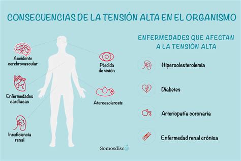 Hipertensión Somosdisc