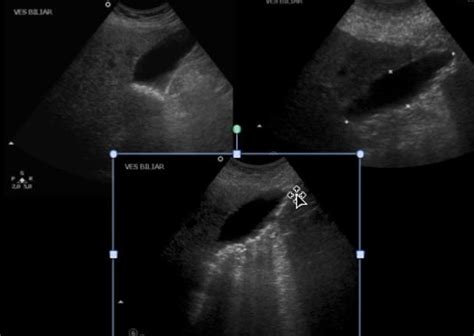 Entendendo a importância e funcionamento das vias biliares Cardiomaster