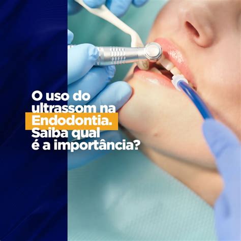 O uso do ultrassom na Endodontia saiba qual é a importância