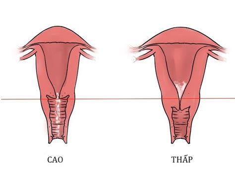 Đặc điểm và tính cách của hình ảnh cổ tử cung khi mang thai mà bạn