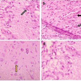 Representative Photomicrographs Of H E Stained Sections Of Brain A