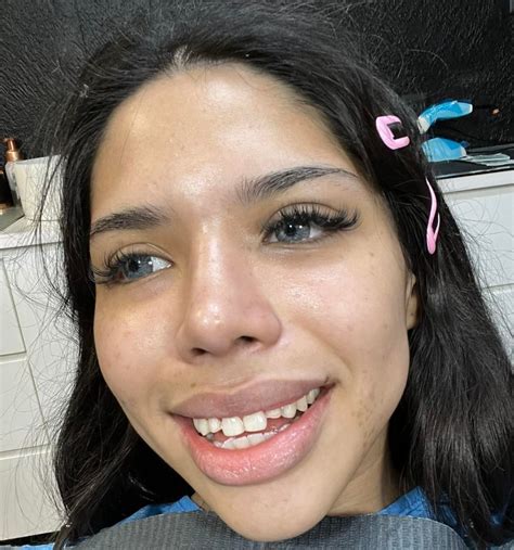 Así Lucía Yeri Mua Antes De Sus Cirugías Estéticas Gobiznext