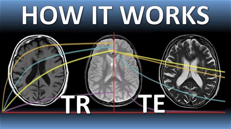 TR TE MRI Image Weighting EXPLAINED Lecture 7