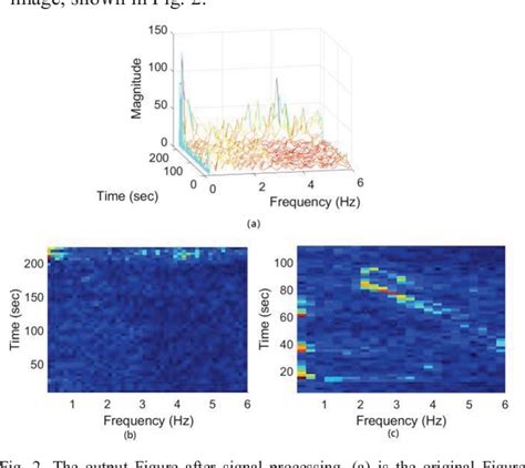 figure 1 from eeg signal epilepsy detection system based on convolutional neural network and