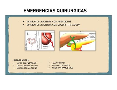 Emergencias quirúrgicas apendicitis y colecistitis aguda Lilian