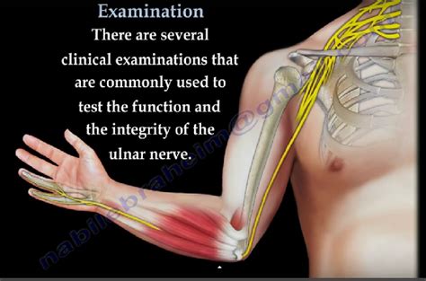 Ulnar Nerve Clinical Examination Orthopaedicprinciples