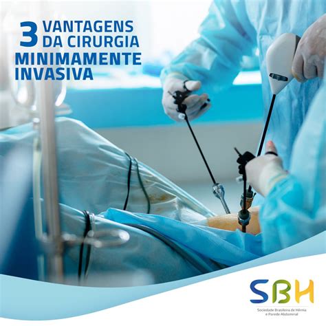 3 Vantagens Da Cirurgia Minimamente Invasiva SBH