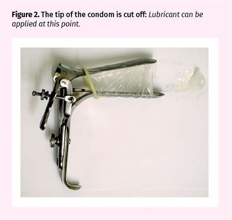 Speculum Exam Technique