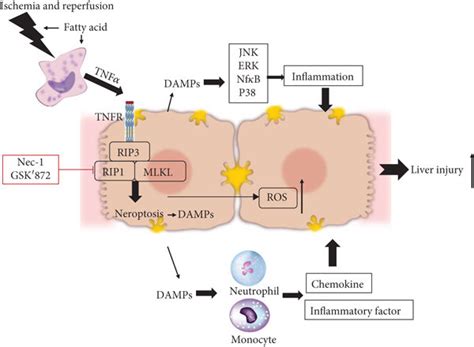TNFα mediated necroptosis aggravates IRI in the fatty liver by