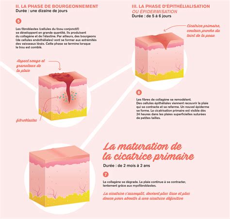 La cicatrisation Vocation Santé