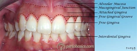 Gingival Dentistry Dental Assistant Study Dental Health