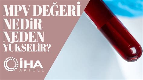 MPV Nedir Neden Yükselir YouTube