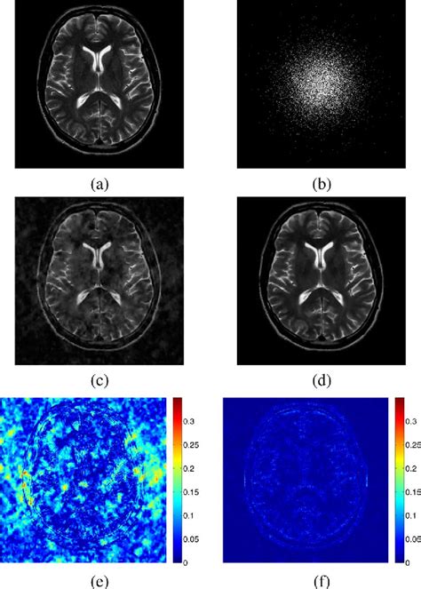 figure 1 from mr image reconstruction from highly undersampled k space data by dictionary