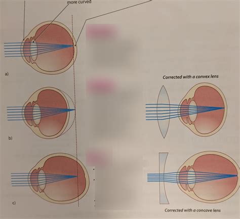 Eye Tests Diagram Diagram Quizlet