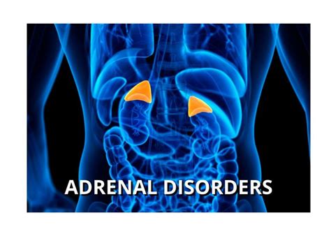 Adrenal Disorders District Endocrine