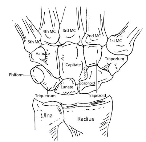 Pin On Trauma Orthopaedic