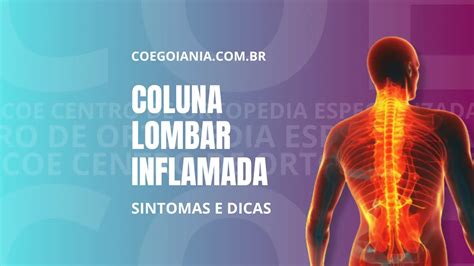 Sintomas De Coluna Lombar Inflamada Como Aliviar A Dor