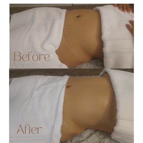 Brazilian Lymphatic Drainage Massage Wrthit Experience Luxury Mobile