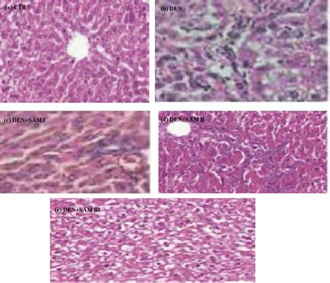 It Shows Photomicrographs H E 400 Of Various Liver Tissues From