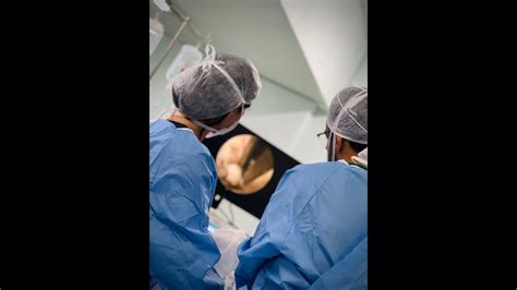 Endoscopia Interlaminar Para Tratamento De Hernia De Disco L5 S1 YouTube