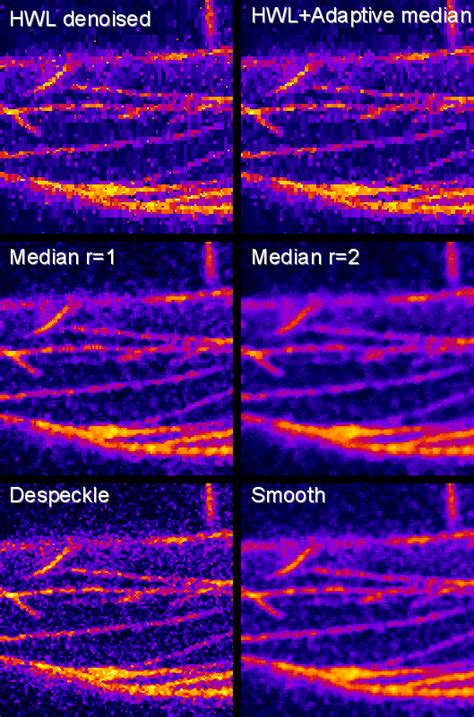 haar wavelet filter and adaptive median filter