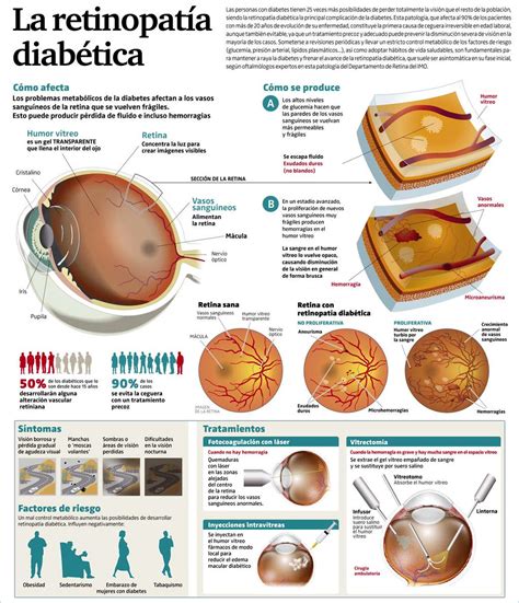 Retinopat A Diab Tica Causas