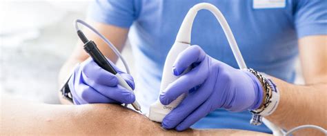 Electrolisis Percutánea una gran alternativa para el tratamiento de