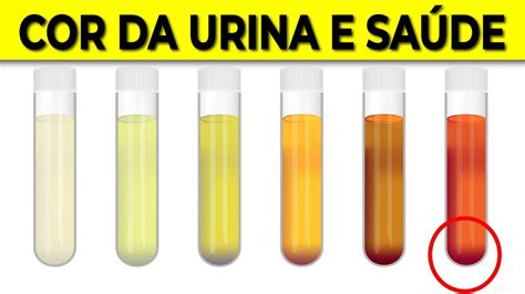O que a cor da sua urina diz sobre sua saúde YouTube