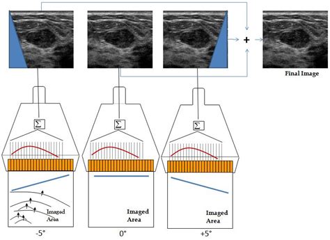 Ultrafast Ultrasound Imaging IntechOpen