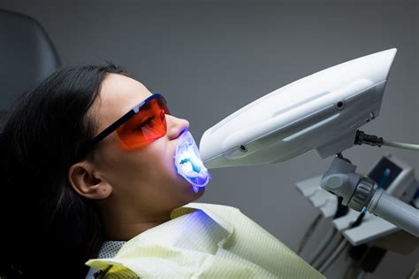 Clareamento Dental Como Funciona Arqui SP