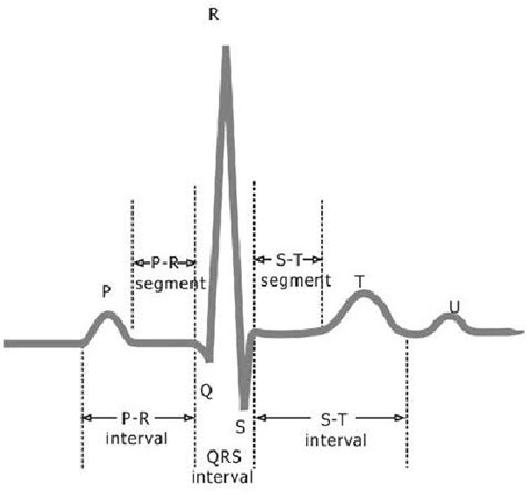 time domain diagram of ecg signal in the time domain diagram of the download scientific