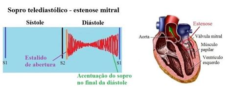 Sopro no coração causas sintomas e tratamento
