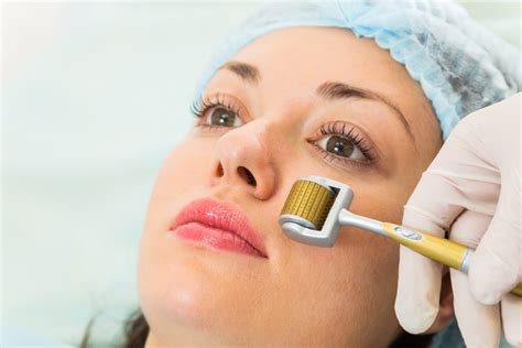 Microagulhamento Dra Ericka Aguiar Dermatologista Clínica Facial